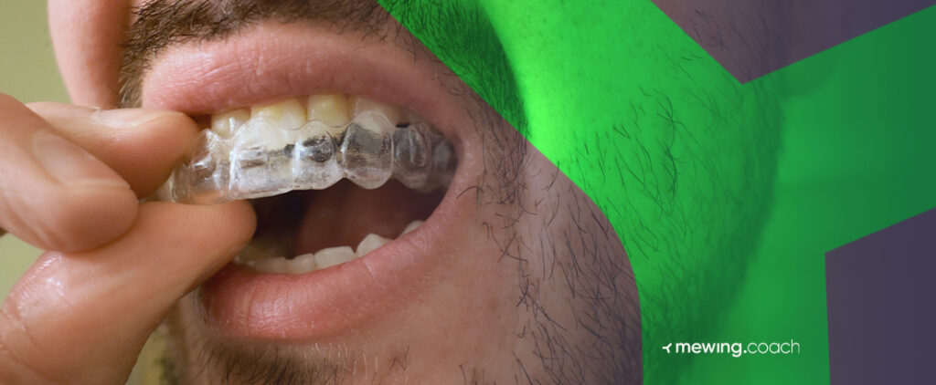 Mewing With Braces: When Does it Work Best? | Mewing.coach