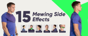 Risks and Side Effects of Improper Mewing: 15 Tips to Avoid Them ...