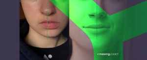 Asymmetrical Jaw & Chin: Causes and How to Fix it Naturally | Mewing.coach