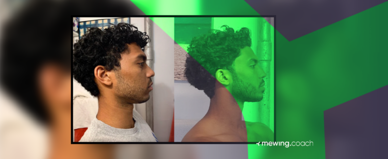 Mewing Benefits: The Complete List | Mewing.coach