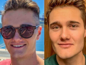 How Mewing Helps You Sculpt Your Jawline? Expert Advises | Mewing.coach