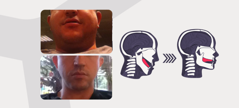 Body Fat Percentage Affects Jawline: Here Is How | Mewing.coach