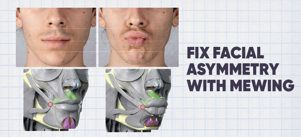 How to Fix Facial Asymmetry With Mewing | Mewing.coach