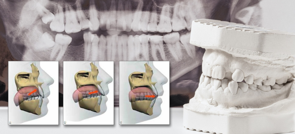 10 Tips on How to Get a Wider Jaw | Mewing.coach