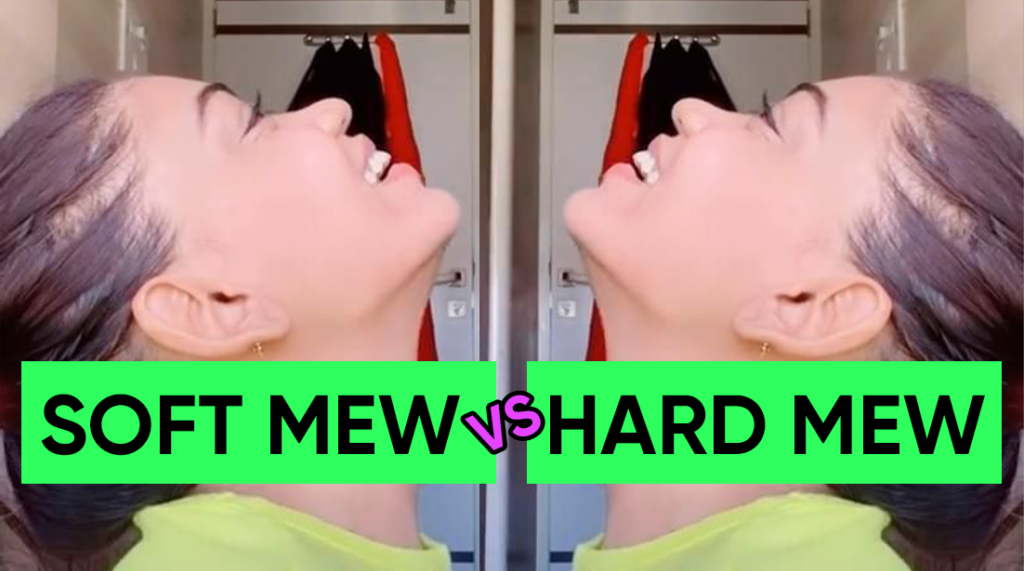 What Is Hard Mewing And How To Make Sure Youre Ready For It Ach
