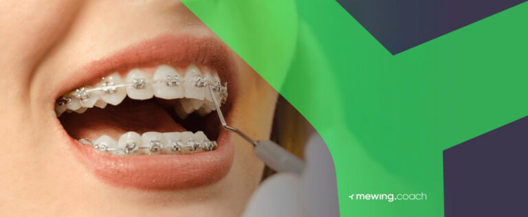 Mewing Guide: 8 Steps to Success (+How To Video & Diagram) | Mewing.coach