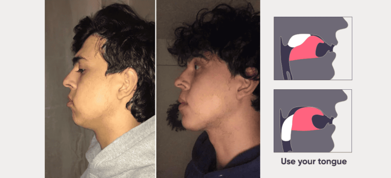 How to Get a Better Jawline: Exercises and Tips | Mewing.coach