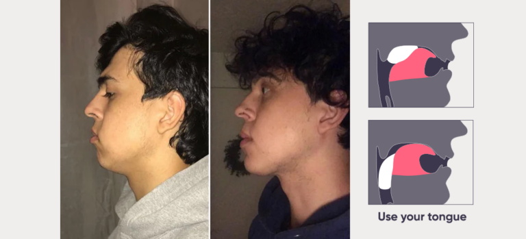 How Tongue Chewing Can Help With Your Mewing Technique | Mewing.coach