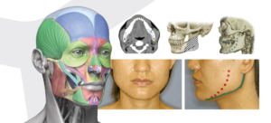 Mewing: Get A More Defined Chin That You Always Wanted!