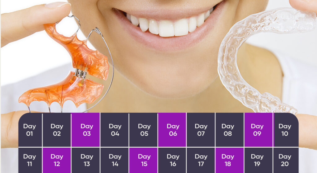 Mewing with Retainers: An In-depth Guide | 2023 | Mewing.coach