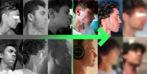 Propper Mewing Tongue Posture & Things to Avoid | Mewing.coach