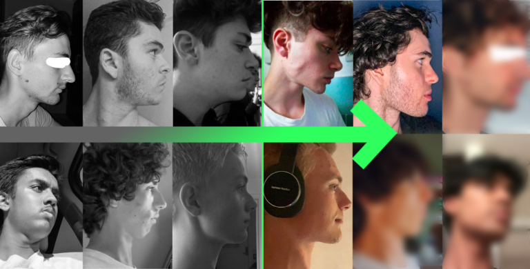 Who Invented Mewing: Dr. John Mew's & Mike Mew's Method | Mewing.coach