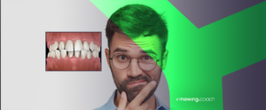 How Can Mewing Fix Crossbite of the Lower & Upper Teeth | Mewing.coach