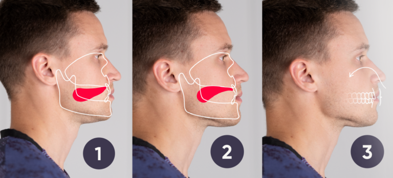 How to Get a Better Jawline: Exercises and Tips | Mewing.coach
