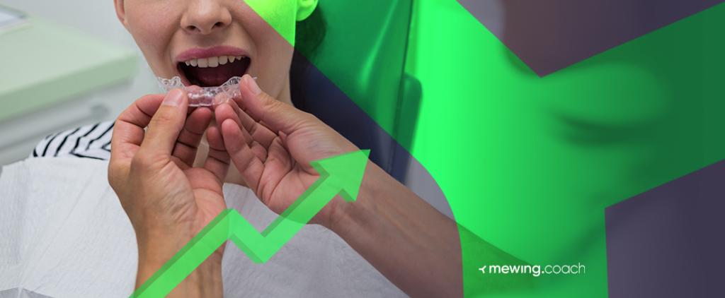 Mewing With Invisalign: Does It Affect Mewing Progress? | Mewing.coach