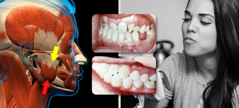 10 Tips on How to Get a Wider Jaw | Mewing.coach