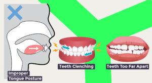 Mewing Is Hard or Uncomfortable? Here's What to Do | Mewing.coach
