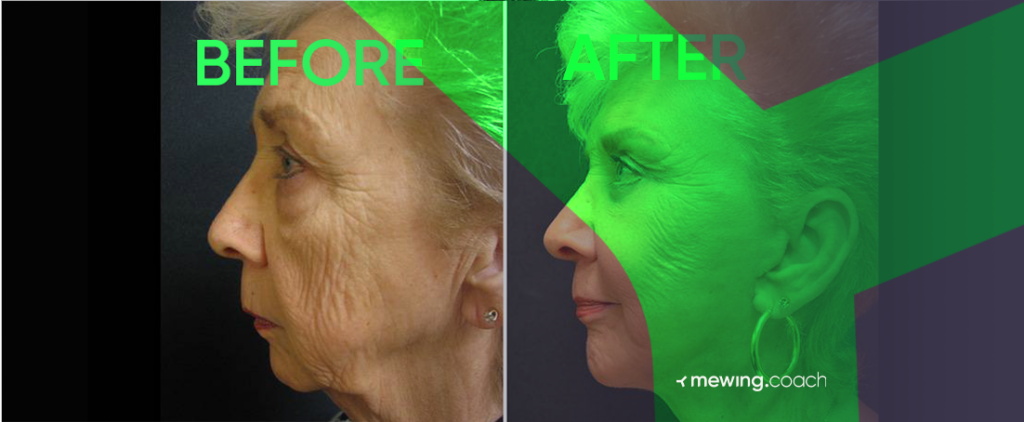 Do You Have a Saggy Jawline? Here Is How to Fix It | Mewing.coach