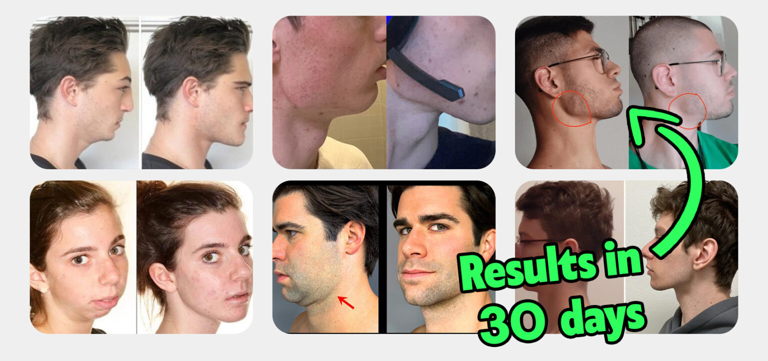 How to Get a Better Jawline: Exercises and Tips | Mewing.coach