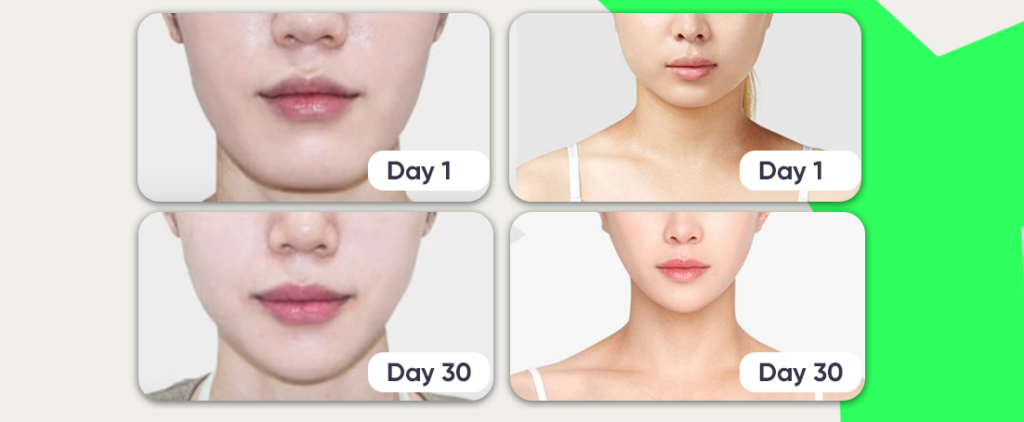 Let's Find Out How to Reduce Square Jaw Naturally | Mewing.coach