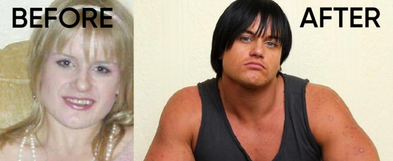 Jawline on Steroids: How Anabolics Affect Your Jaw Shape | Mewing.coach