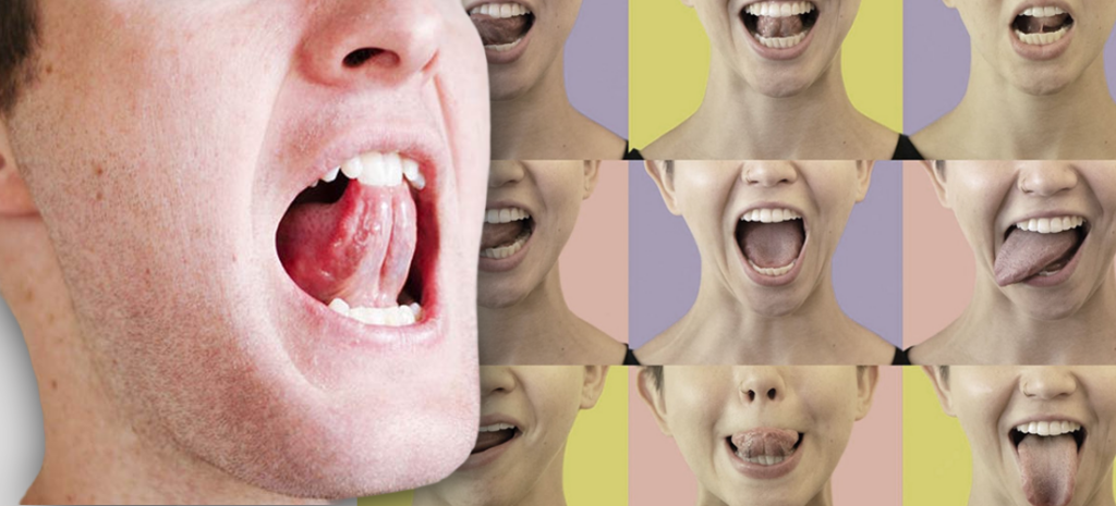 10 Tips on How to Get a Wider Jaw | Mewing.coach