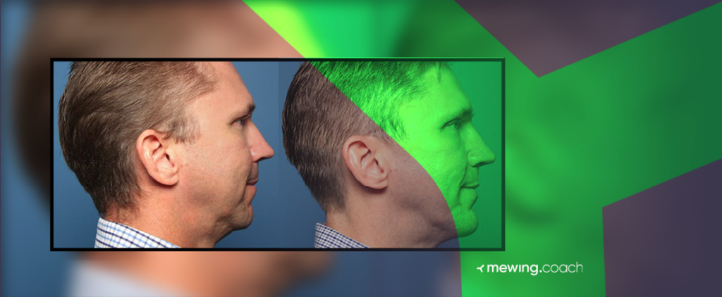 How Old is Too Old for Mewing: Is There an Age Limit at All? | Mewing.coach