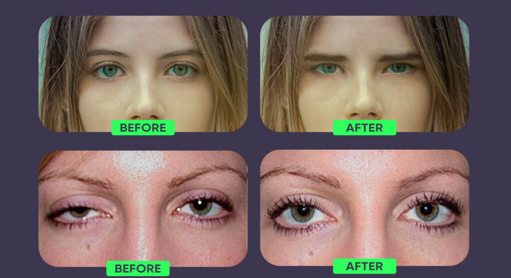 How Does Mewing Affect the Eyes: A Guide | Mewing.coach