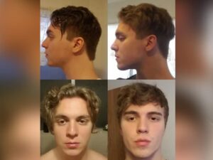 How to Get a Better Jawline: Exercises and Tips | Mewing.coach