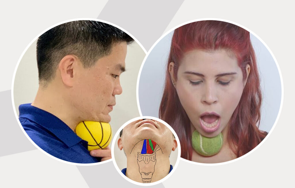 Double Chin While Skinny: Causes and How to Get Rid of It | Mewing.coach