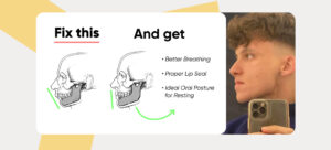 Forward Facial Growth: The Comprehensive Guide | Mewing.coach