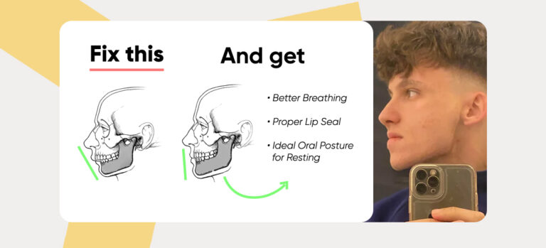 Forward Facial Growth: The Comprehensive Guide | Mewing.coach