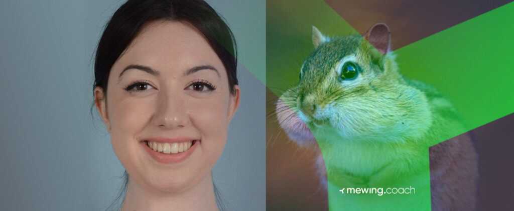 6 Ways How to Get Rid of Chipmunk Cheeks Without a Surgery | Mewing.coach