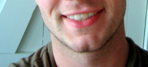 10 Different Types & Shapes of Chin: A Comprehensive List | Mewing.coach