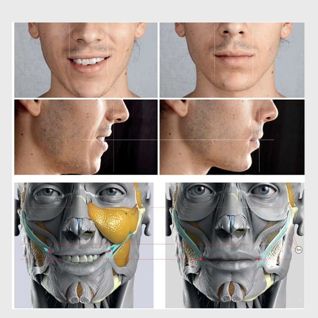 Face Yoga for Double Chin: 12 Most Effective Exercises | Mewing.coach