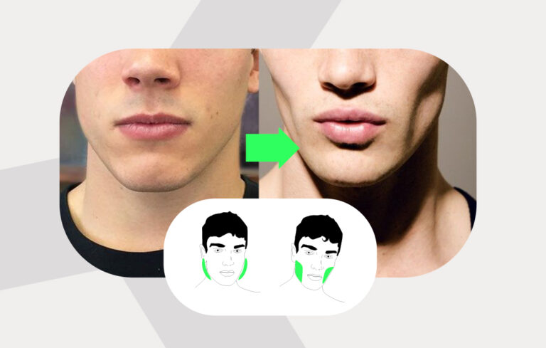 Find Out How to Get Hollow Cheeks: 16 Different Ways | Mewing.coach