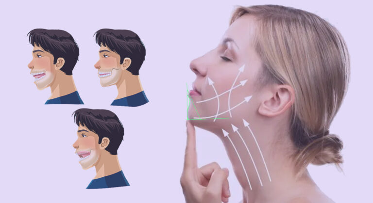 How to Get Rid of a Pointy Chin if It’s Too Visible to Your Liking | Mewing.coach