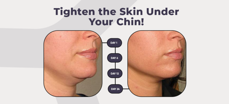 12 Non-Surgical Ways To Tighten the Skin Under Your Chin | Mewing.coach