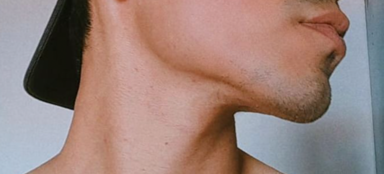 10 Different Types & Shapes of Chin: A Comprehensive List | Mewing.coach