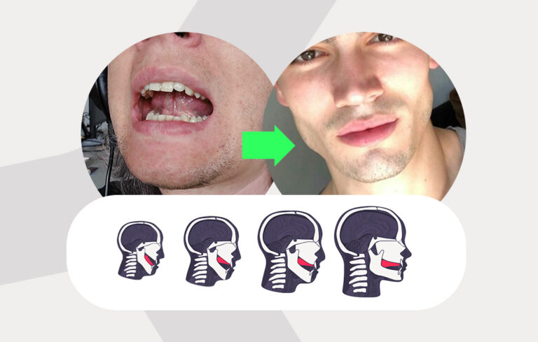 Find Out How to Get Hollow Cheeks: 16 Different Ways | Mewing.coach