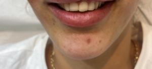 10 Different Types & Shapes of Chin: A Comprehensive List | Mewing.coach