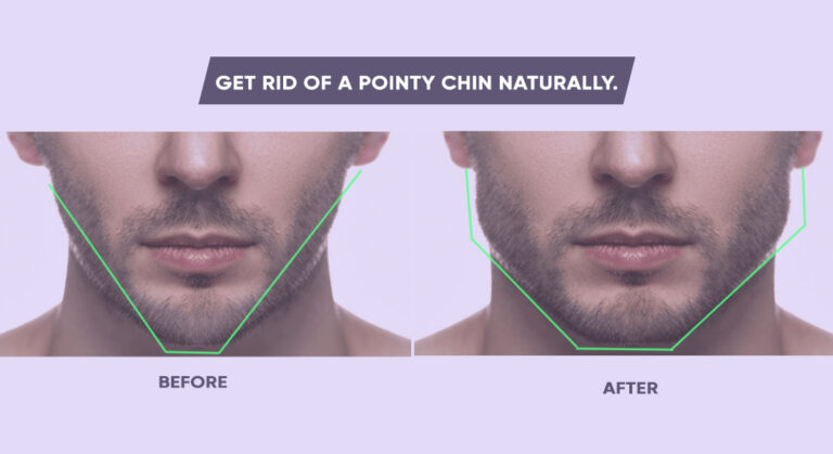 How to Get Rid of a Pointy Chin if It’s Too Visible to Your Liking ...
