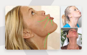 Double Chin While Skinny: Causes and How to Get Rid of It | Mewing.coach