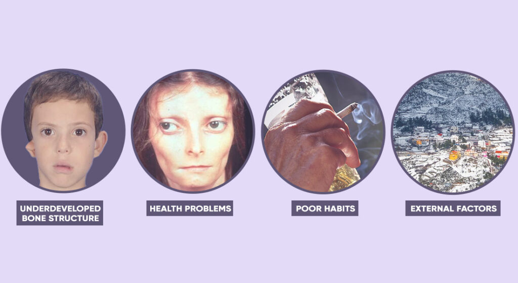 Sunken or Flat Cheekbones: What Could be Done About Them | Mewing.coach