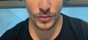 10 Different Types & Shapes of Chin: A Comprehensive List | Mewing.coach