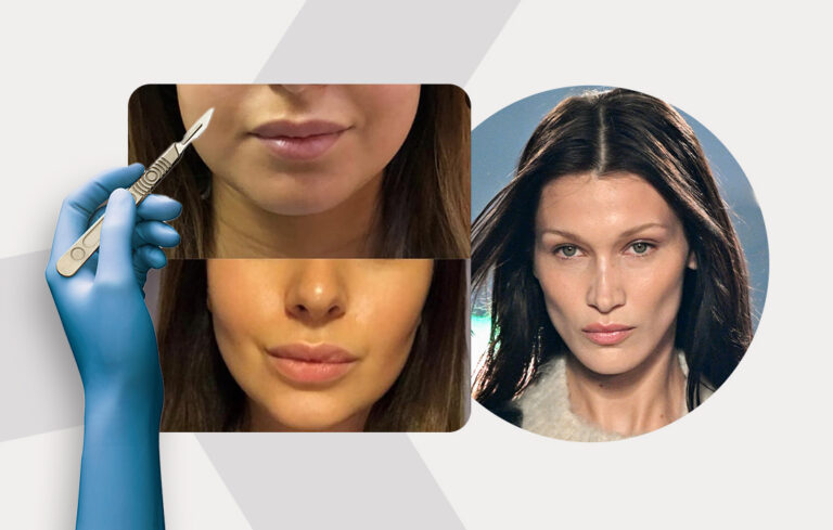 Find Out How to Get Hollow Cheeks: 16 Different Ways | Mewing.coach