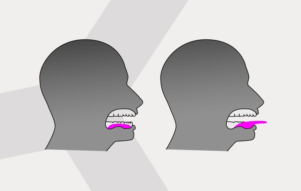 Double Chin While Skinny: Causes and How to Get Rid of It | Mewing.coach