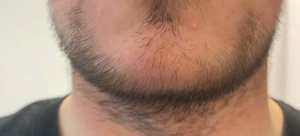 10 Different Types & Shapes of Chin: A Comprehensive List | Mewing.coach