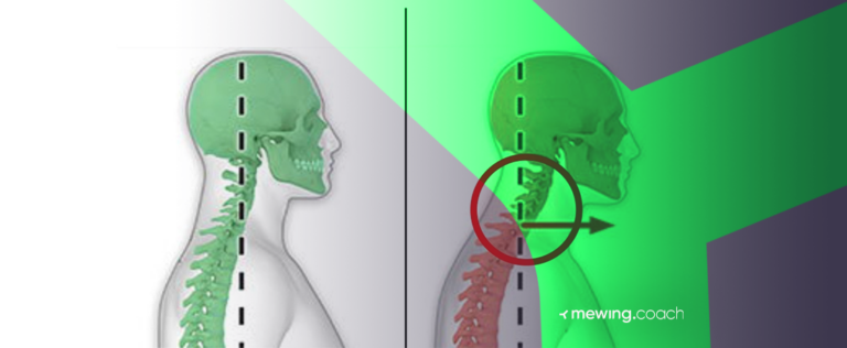 Mewing for Neck Pain Relief: How it Could Ease Your Discomfort | Mewing ...