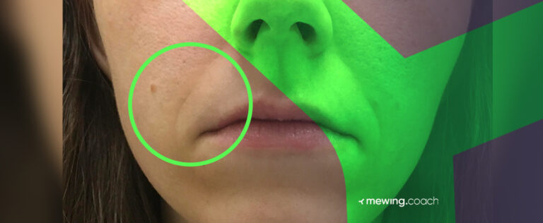 14 Ways How To Get Rid of Fine Lines Around Mouth | Mewing.coach